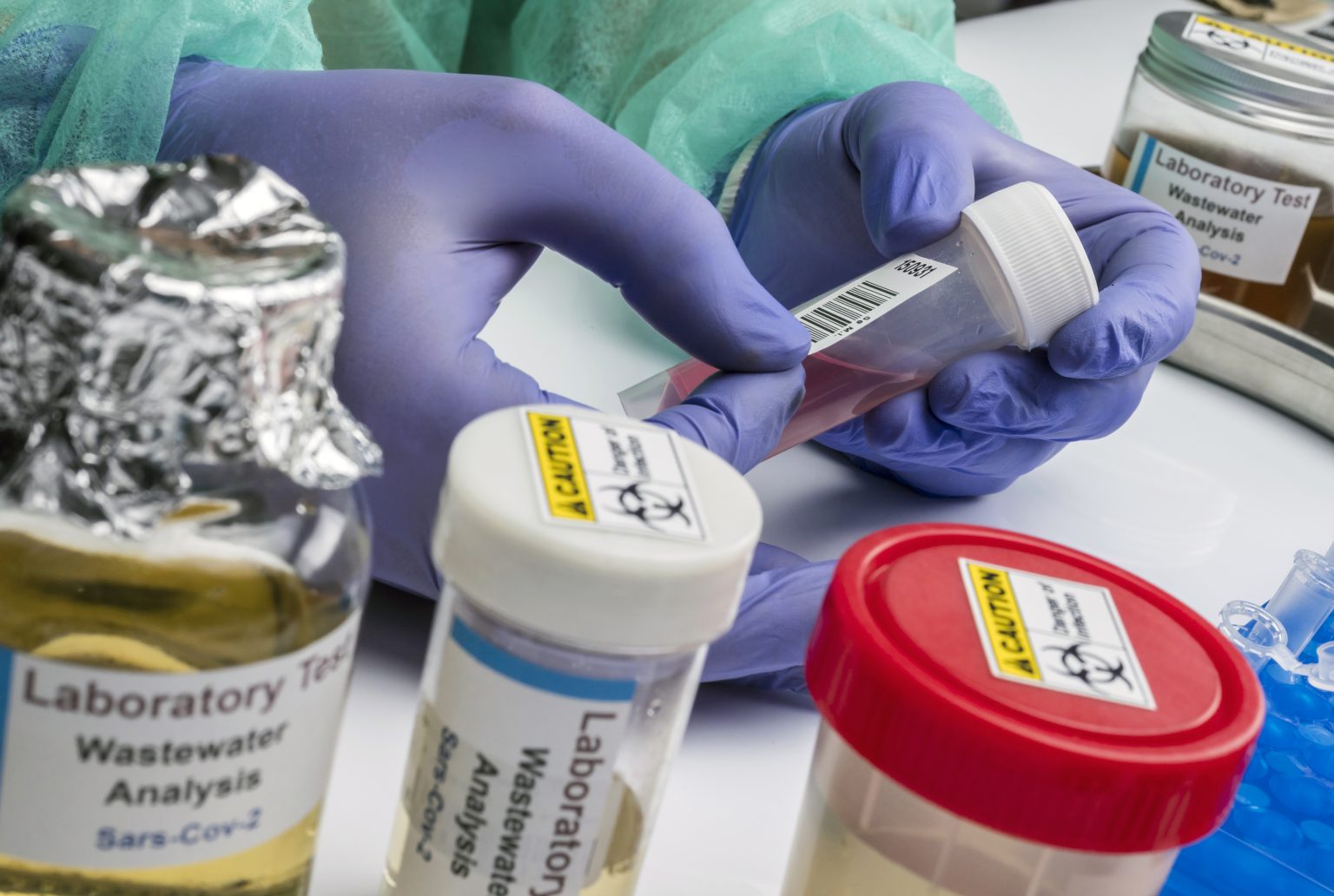 Water-transmitted viral pathogens collection kit - ABL Diagnostics S.A.