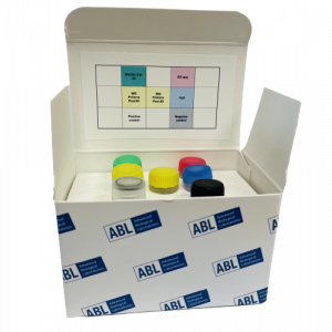 DeepChek® Assay Whole Genome SARS-CoV-2 Genotyping - ABL Diagnostics S.A.